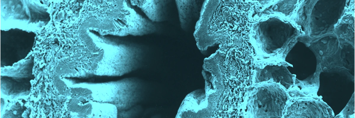 RESPIRE-EXCEL: EU funds asthma and COPD research at LHI and PRM