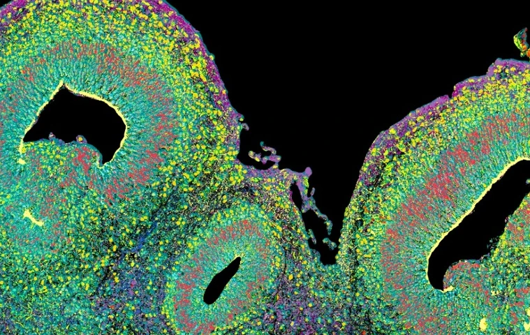 Home [www.helmholtz-munich.de]