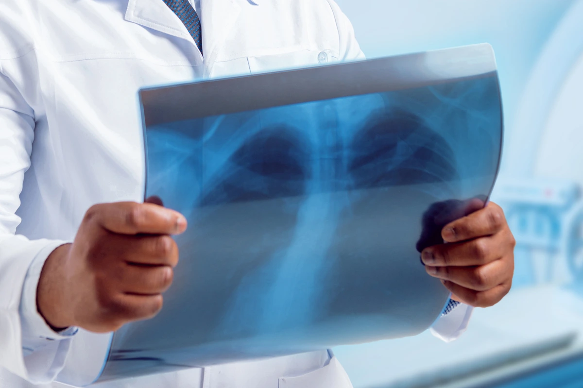 Renal Function After Administration of Contrast Media: New Study Launched