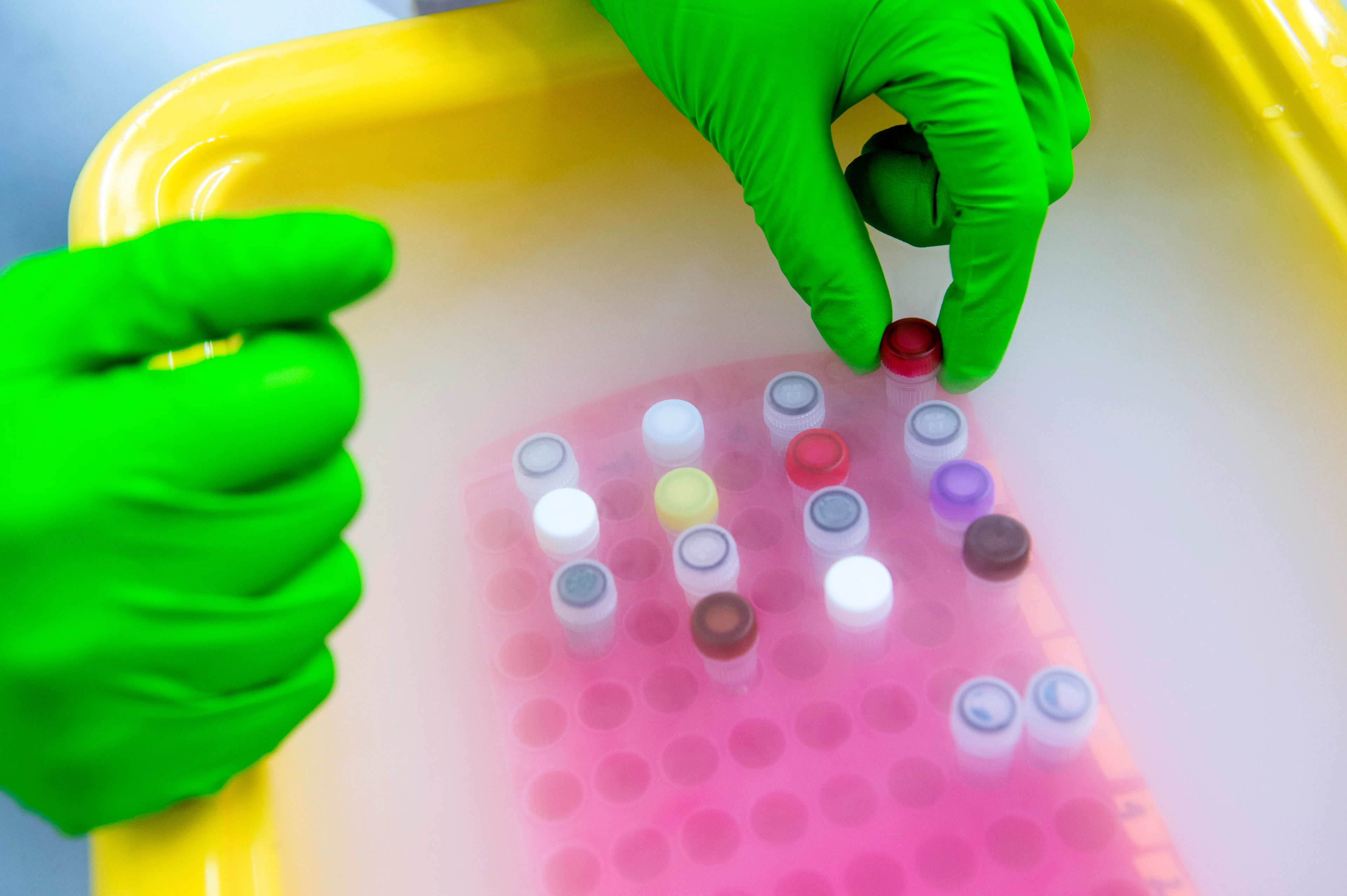 Helmholtz Munich startet mit EU-Partnern wegweisendes Projekt zur ...