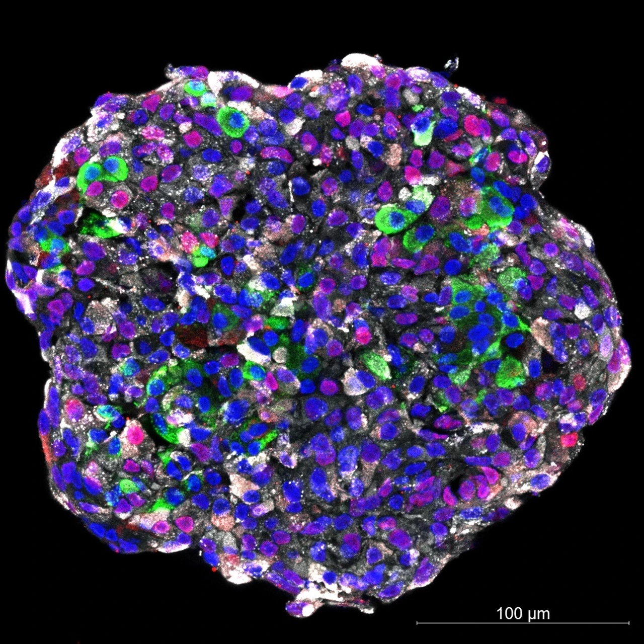 Beta Cell Replacement