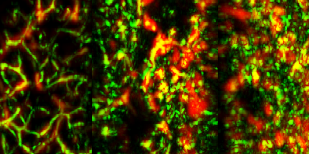 IBMI Optoacoustic Mesoscopy